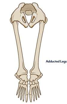 Postural Problems in Seating: Abduction vs Adduction - Vivid Care